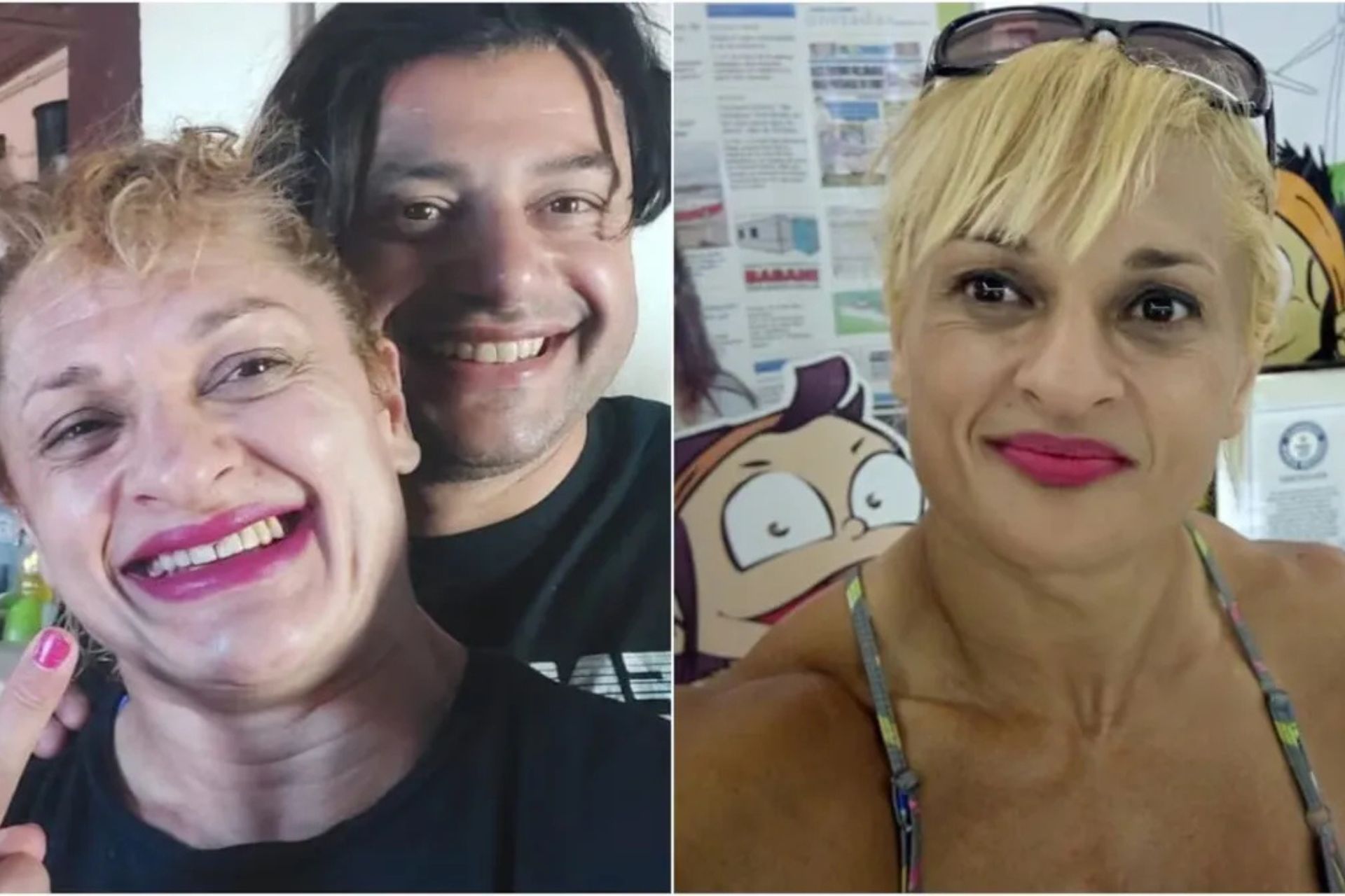 Jesús Olivera: "El daño en el tronco encefálico es irreversible ...